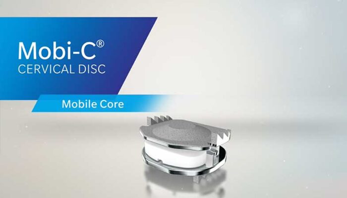 Cervical Spine Surgery Procedures